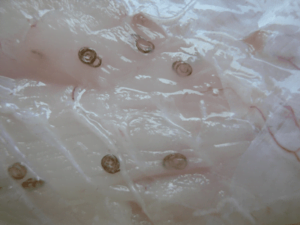 ¡Anisakis, todo lo que debes saber! | Dr. Sabo Alloca