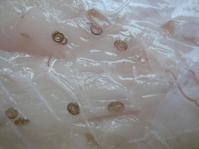 ¡Anisakis, todo lo que debes saber! | Dr. Sabo Alloca